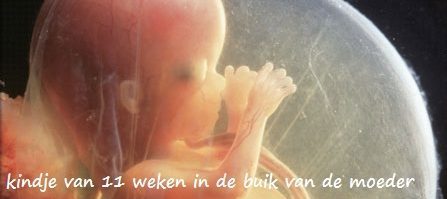 Alle Abortus Informatie als je ongepland - ongewenst zwanger bent